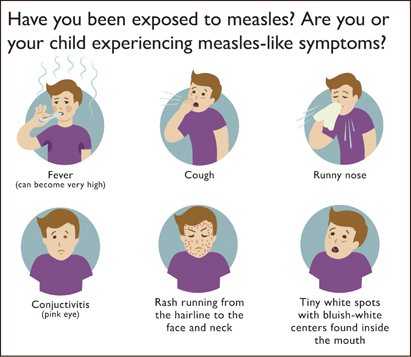 Preventing Measles – McCreary Journal